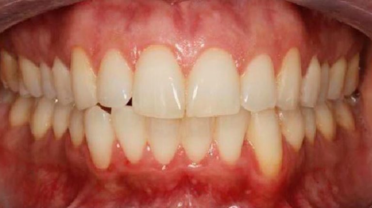 Maxilar y mandíbula, ¿qué son y en qué se diferencian?